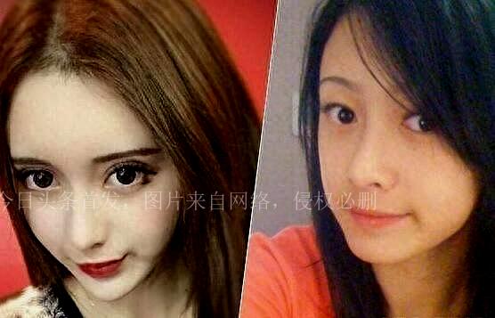 At the scene where actresses underwent plastic surgery, some looked ...