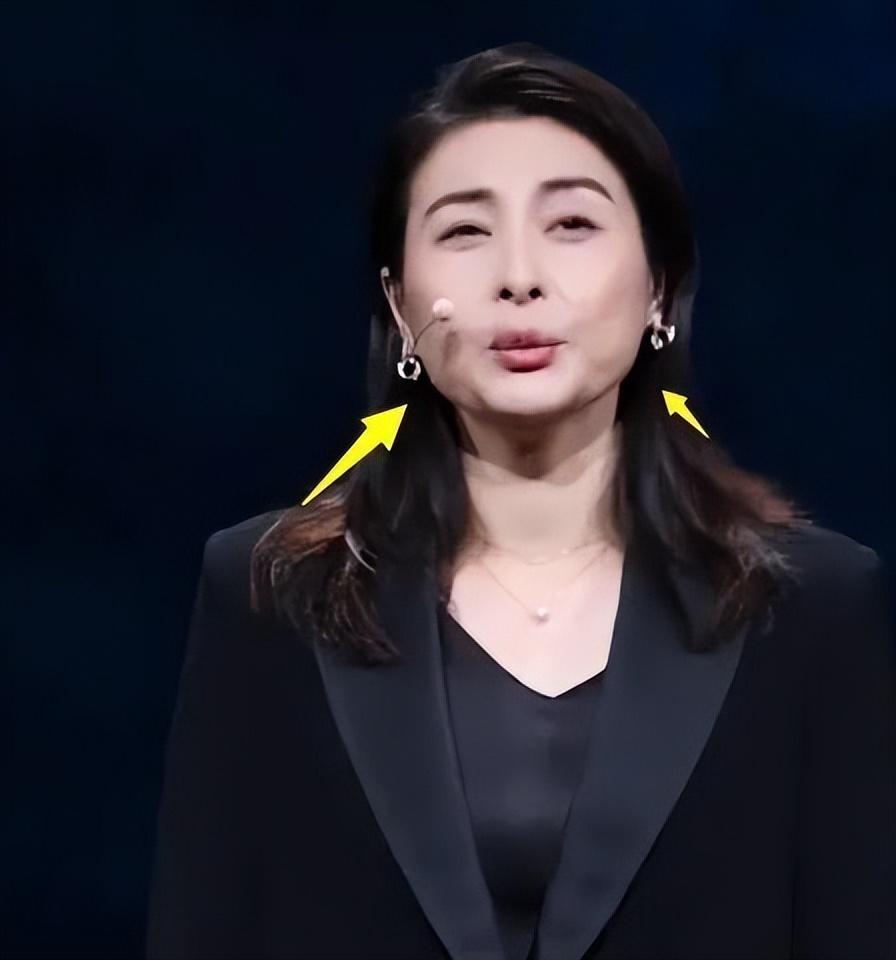 41-year-old Guo Jingjing gave a speech at an event, her cheek hair ...