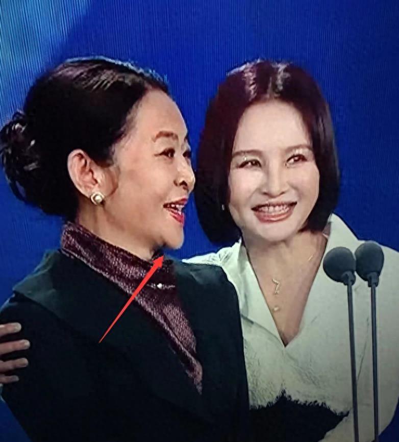 Ni Ping's amazing face after plastic surgery, her long pointed chin is ...