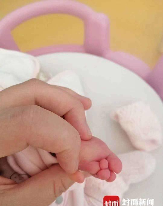 Four-dimensional color ultrasound showed that a baby with "hands" was ...