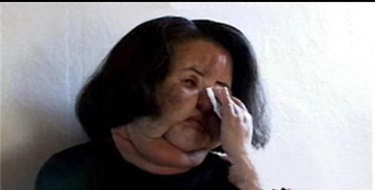 "Addicted to plastic surgery" Han Huijing: She transformed her face ...