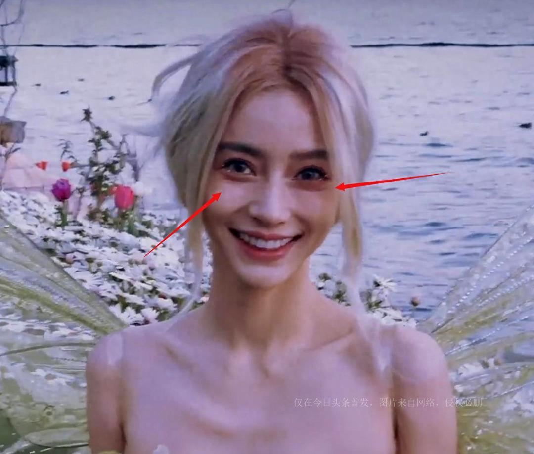 10 thin and disfigured actresses: skin and flesh loss, walking ...