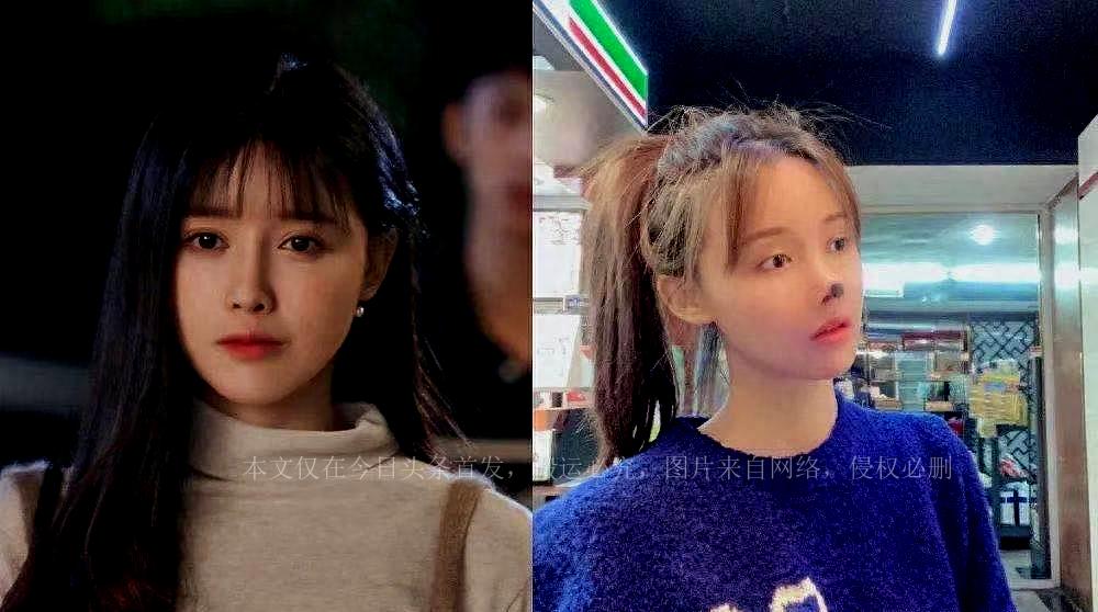 The truth about 25-year-old actor Gao Liu's plastic surgery failure is ...