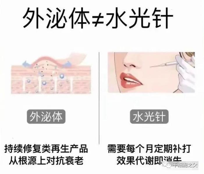 Stem cell exosomes vs. water-light needles: Which one is more effective ...