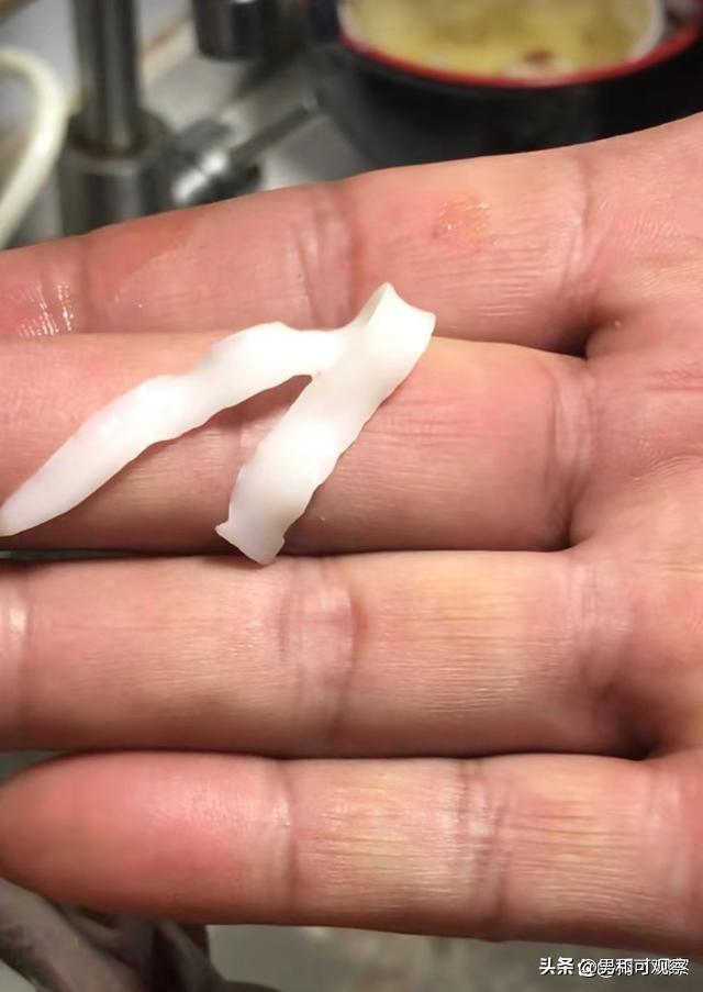 A 4.95-meter-long tapeworm drilled out of a Hunan woman's body. It is ...