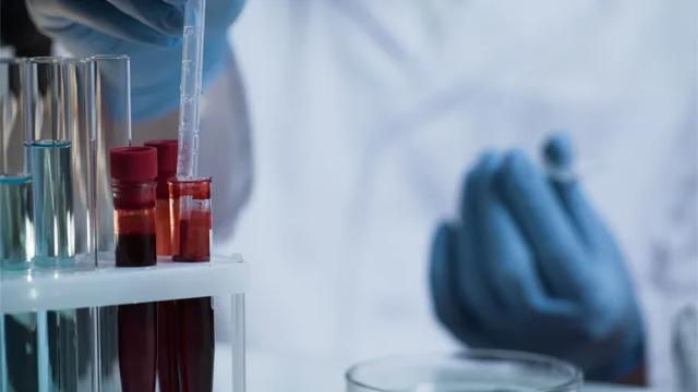 Two indicators of diagnostic experiments! Sensitivity and Specificity ...