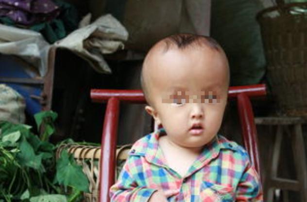 Children with bigger heads are smarter?mistaken!It is these "two parts ...