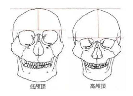 What is the high cranial top and the head covering the face? - iNEWS