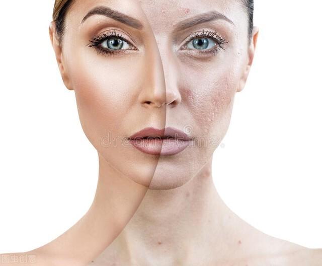 Skin care changes with the 'season' - iNEWS