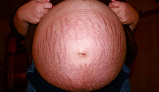 Can't tell the difference between fat lines, growth lines, and stretch ...