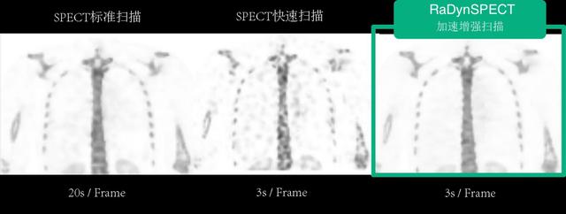 One article to understand the importance of SPECT in nuclear imaging ...