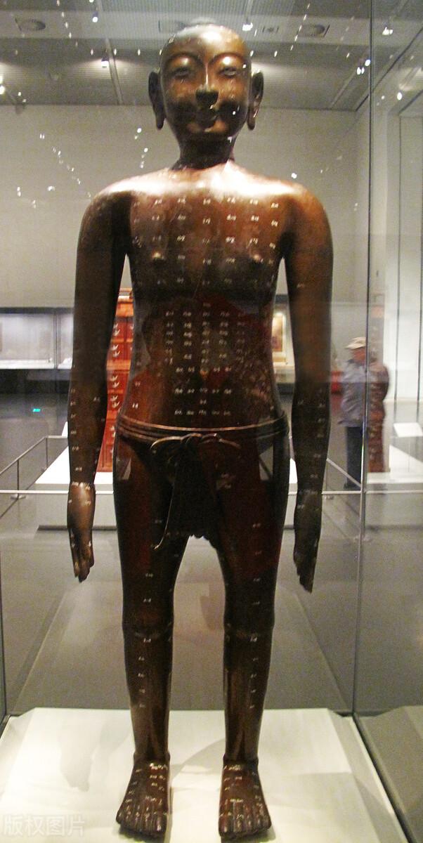 What is the bronze figure of acupuncture and moxibustion in the Song ...