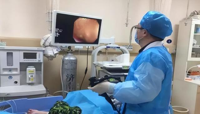 Why do most people reject colonoscopy?How long is the "validity period ...
