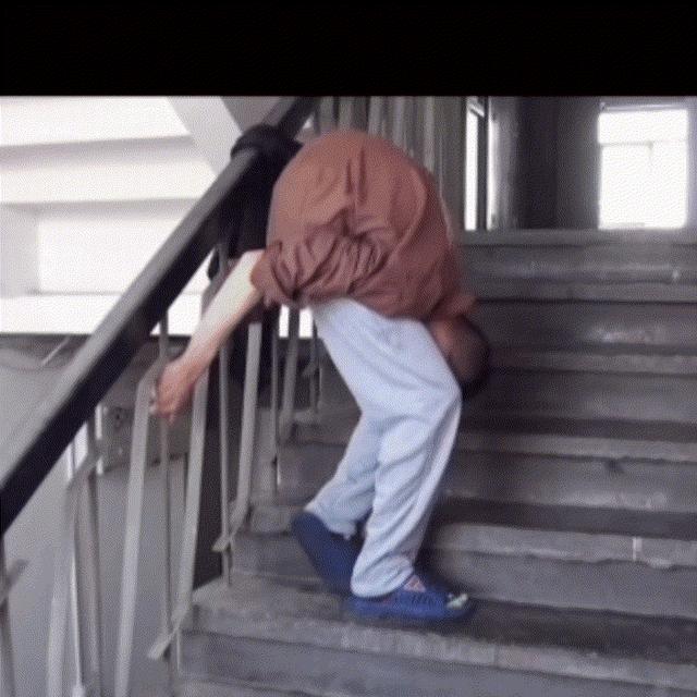 Folding people!That's right, the folded person, ankylosing spondylitis ...