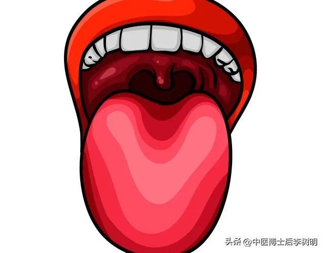What do the different colors of the tongue mean? - iNEWS