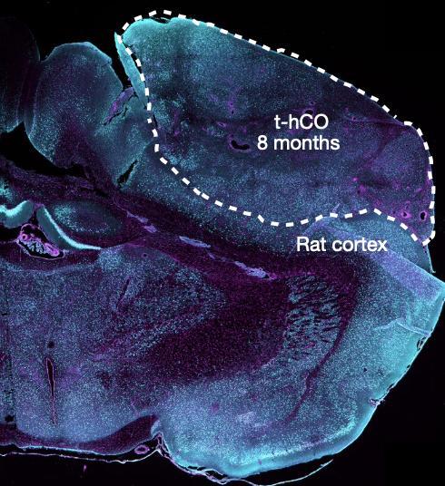 The human-mouse hybrid brain has appeared!Stanford University 7 years ...
