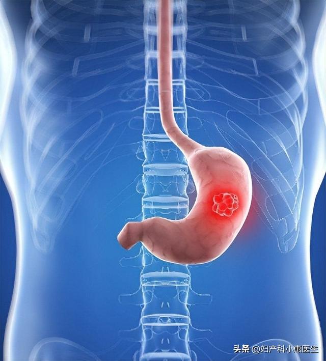 Shanghai Chest Hospital has a new drug targeting KRAS!Conquer the ...