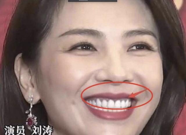 'Fake' stars: Fake teeth, fake acting, even a fake ass - iNEWS