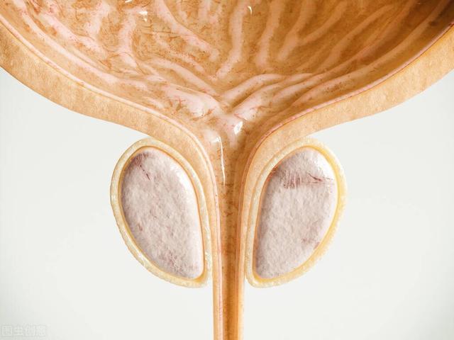 How long does the treatment cycle take for prostate calcifications ...