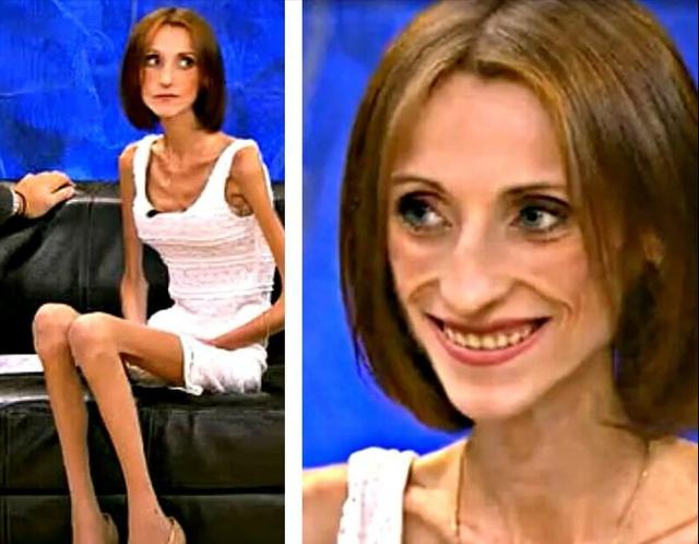 The 26 kg beauty gained weight in 9 years and finally succeeded: learn ...