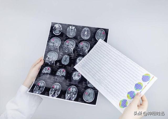 Safety confirmed! Applicable multiple sclerosis drug for the Chinese ...