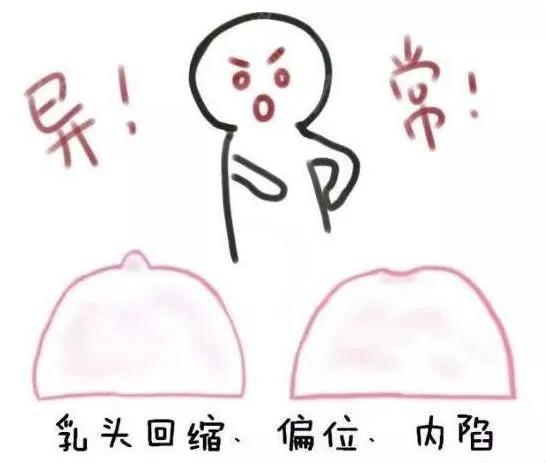 What's wrong with inverted nipples?The doctor teaches you to ...