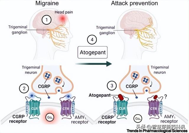 Focusing on the field of migraine treatment, AbbVie's self-developed ...