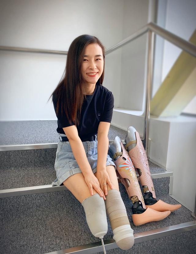 The most beautiful "broken leg dancer" lost her legs and daughter after ...