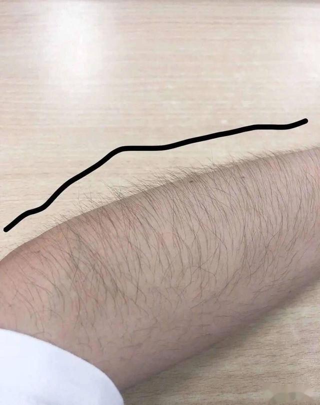 Why do Caucasians have more body hair than our yellow race? Is it ...