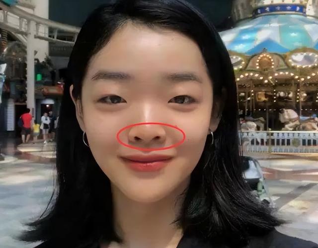 What's more terrifying than "collapsed nose" is "showing nostrils ...