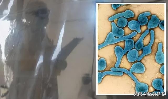 "Death within 24 hours of onset of symptoms", a deadly disease ...