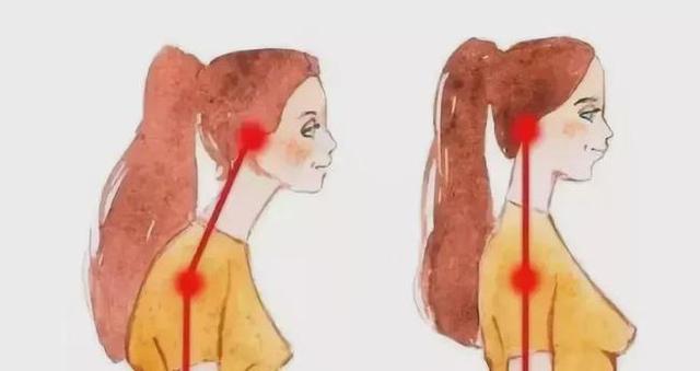 A few actions to correct the "turtle neck" and restore your beautiful ...