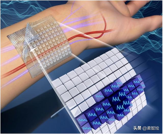 Measuring pulse waves with thin printed patch sensors - iNEWS