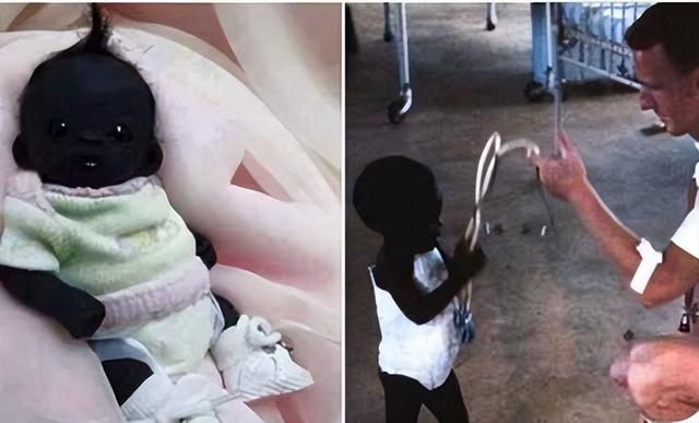 World's blackest child born in South Africa - iNEWS