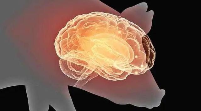 Pig brains can be resurrected, does that mean the bodies in the morgue ...