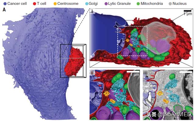 Attack and Seal - Tumor cell ESCRT mediates plasma membrane repair in ...