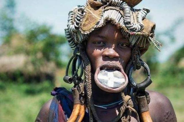 A 10-year-old girl cuts her lower lip into a plate without anesthesia ...