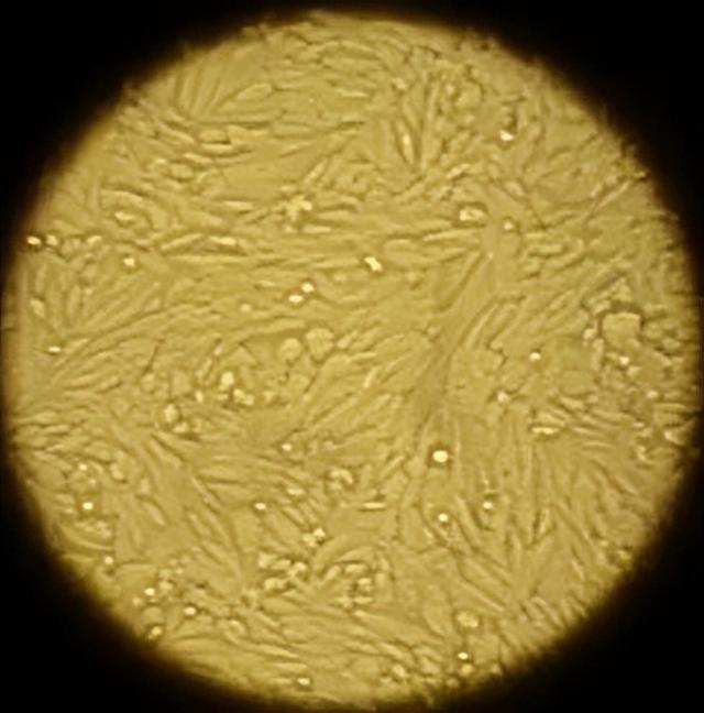Digestive problems with adherent cells - iNEWS