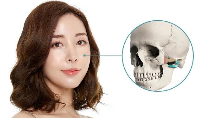 Can different height cheekbones be corrected? - iNEWS