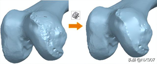 UG reverse shear to remove imperfect areas and fill holes - iNEWS