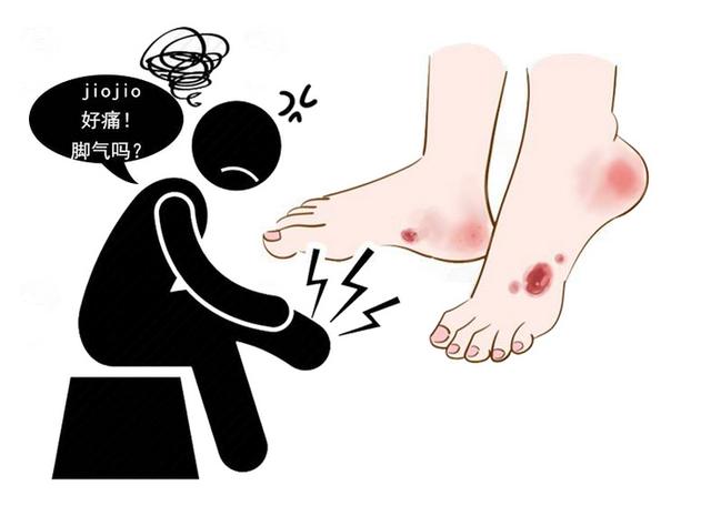 Diabetic patients beware of "rotten feet", it is recommended to do 3 ...