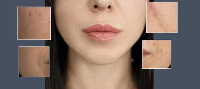 The doctor judges a woman has a tumor by looking at her "face"!9 "faces ...