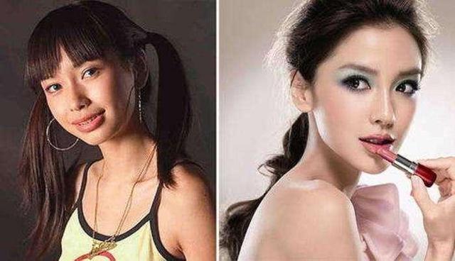 Several stars with excessive plastic surgery, with stiff faces and ...