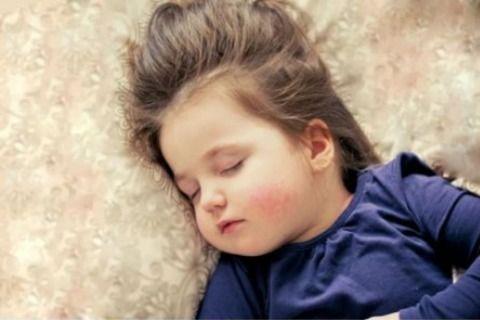 Eczema and redness in the changing seasons?Baby Harding's one trick to ...