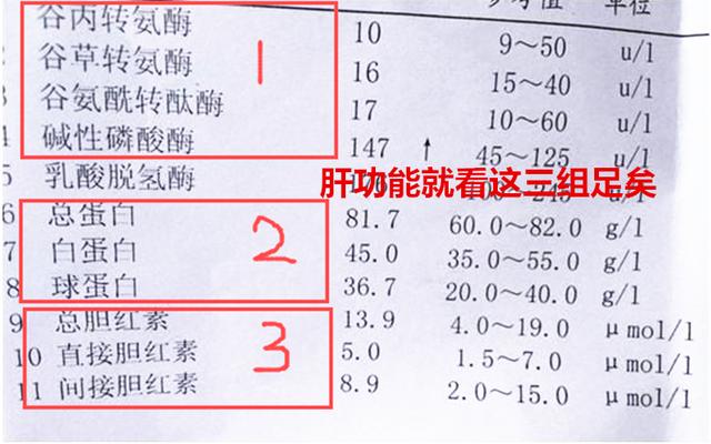 Liver function test sheet, just understand these three groups of ...