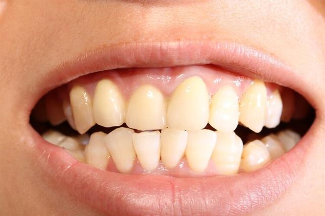 Why does something smeared out of your teeth smell so bad, but you can ...