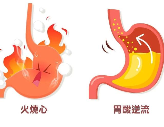 Old Chinese medicine sees fire and heartburn, 4 kinds of stomach types ...