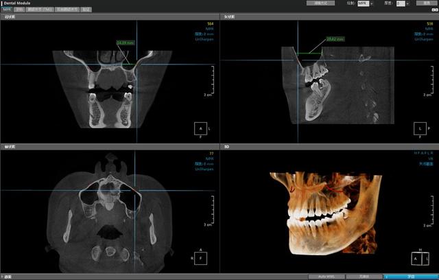 Common additional examinations for ENT medical examination: cone beam ...