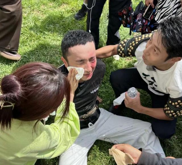 Nigma was accidentally injured during the recording program! My face ...