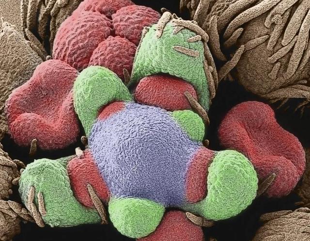 This is what flowers, stamens, and pollen look like under the ...